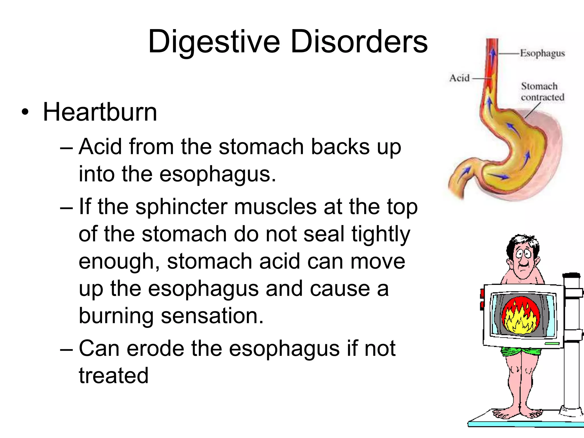 The digestivesystem and disorders | PPTX