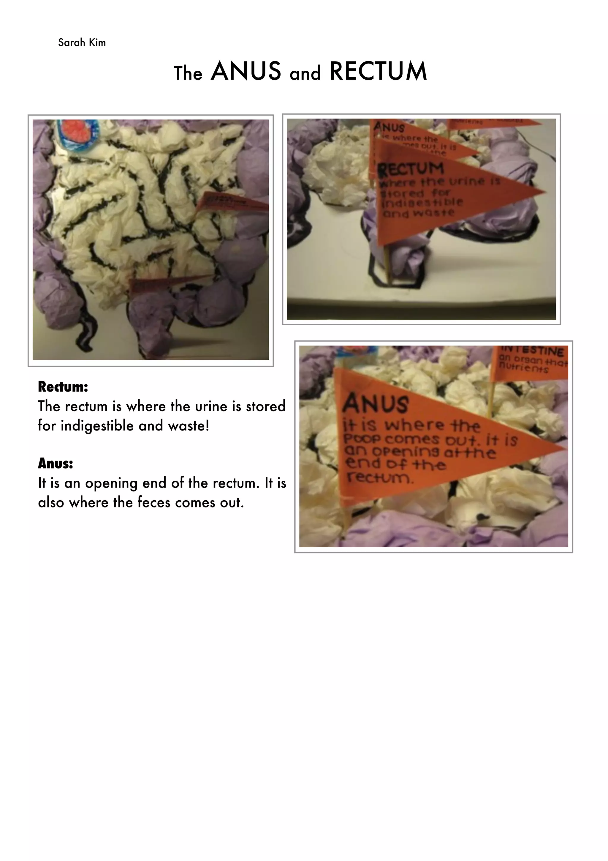 The Digestive System: Model | PAGES