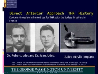 The Direct Anterior Hip Replacement | PPTX