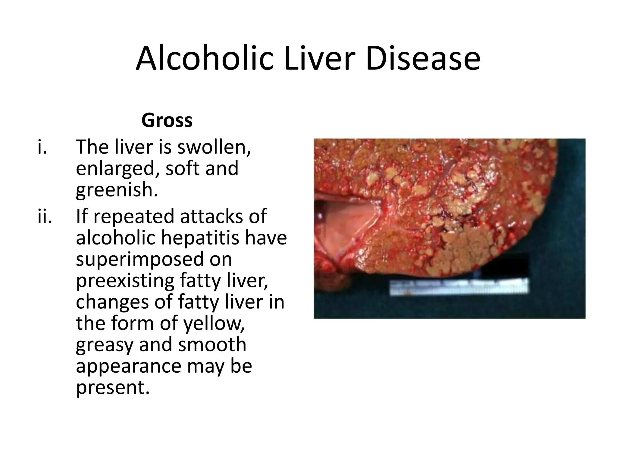 The diseases of the hepatobiliary system | PPTX