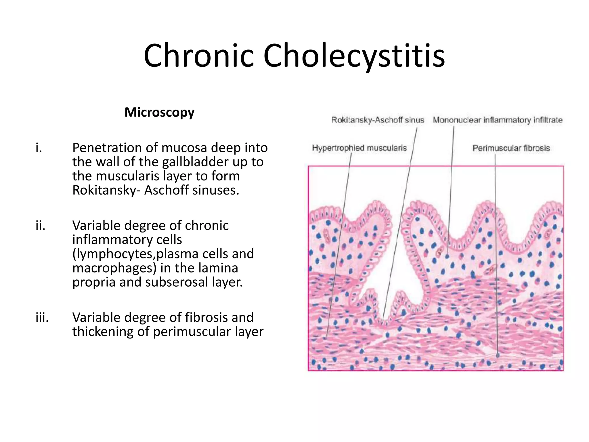 The diseases of the hepatobiliary system | PPTX