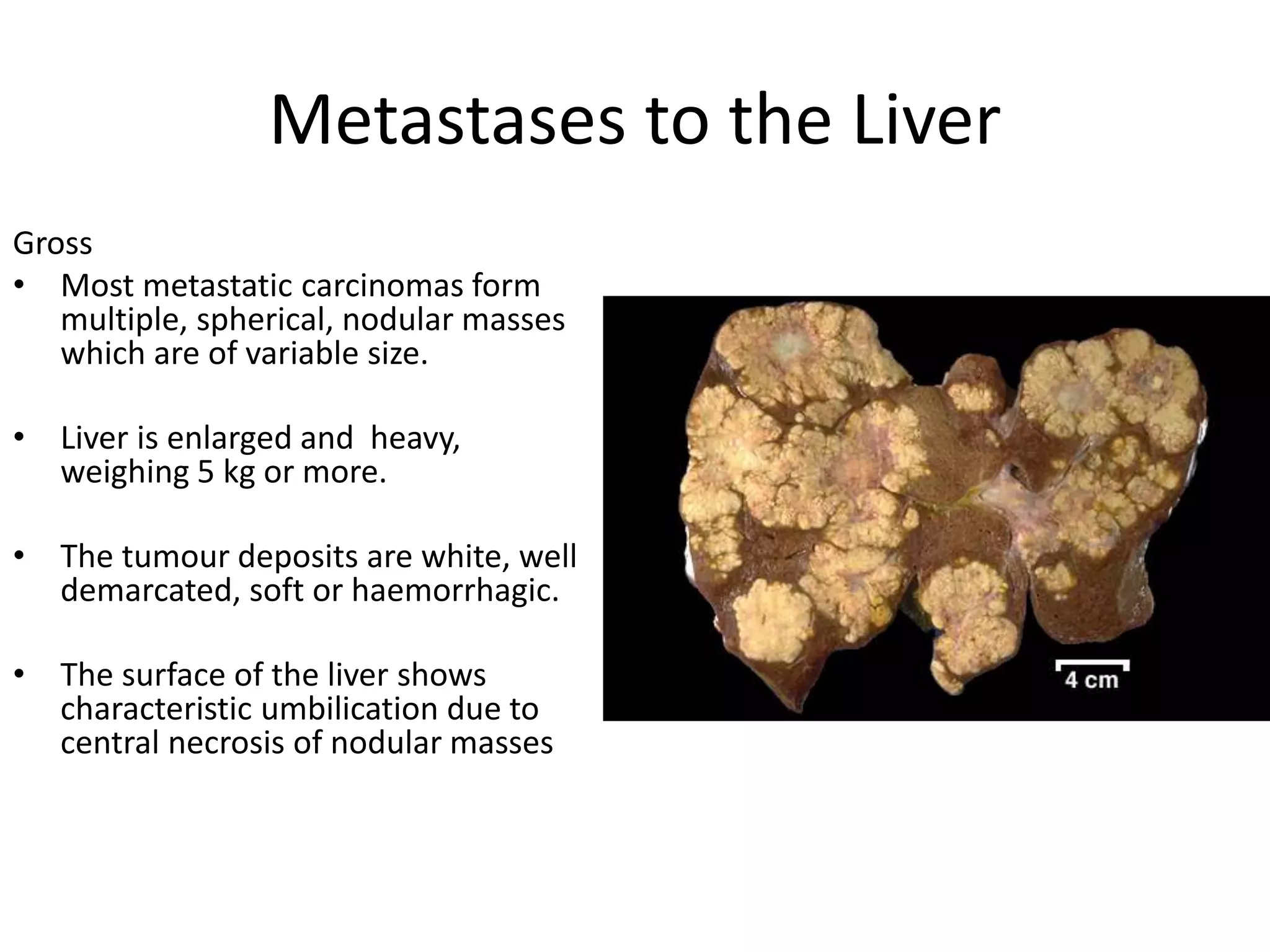 The diseases of the hepatobiliary system | PPTX