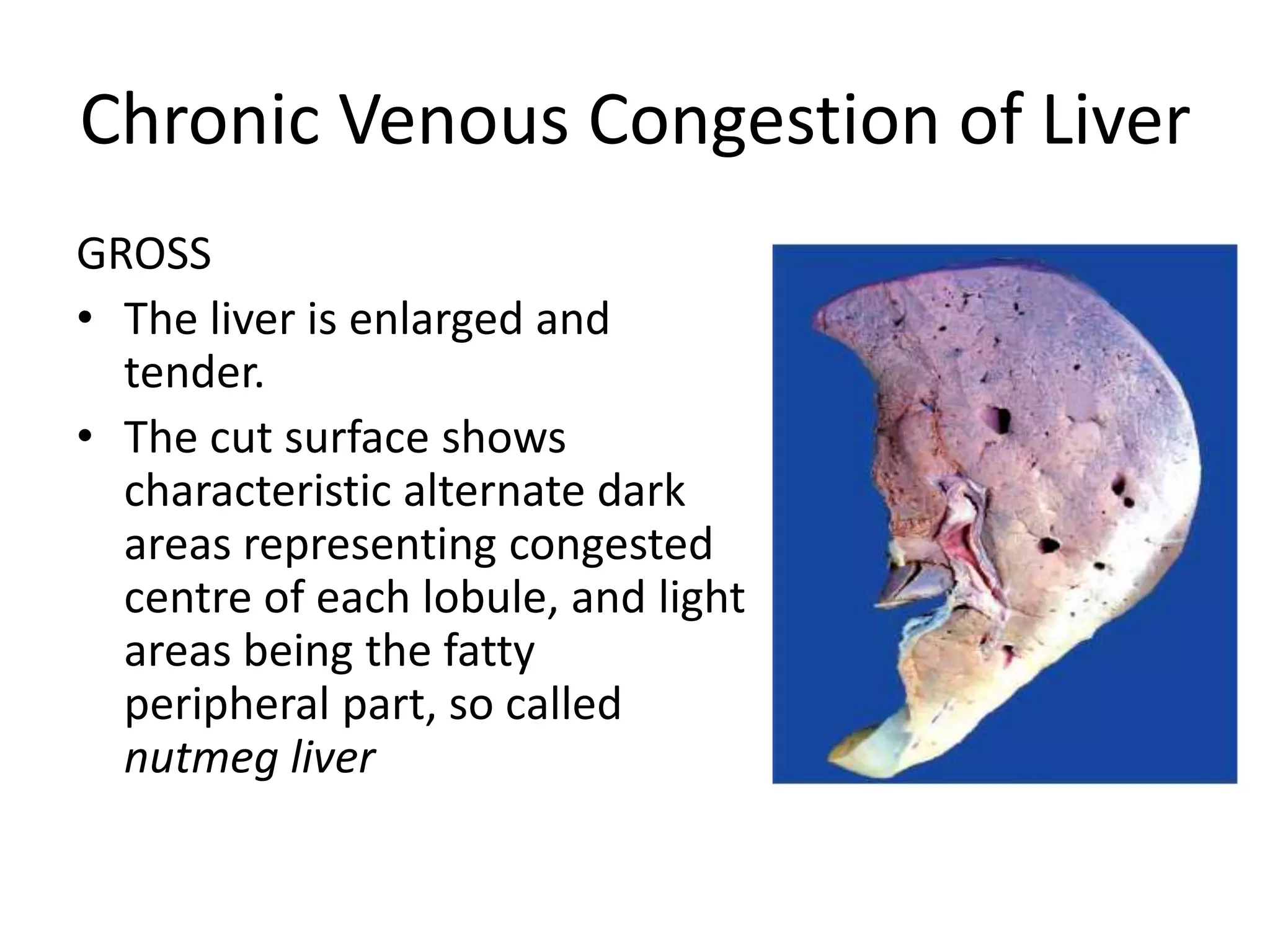 The diseases of the hepatobiliary system | PPTX