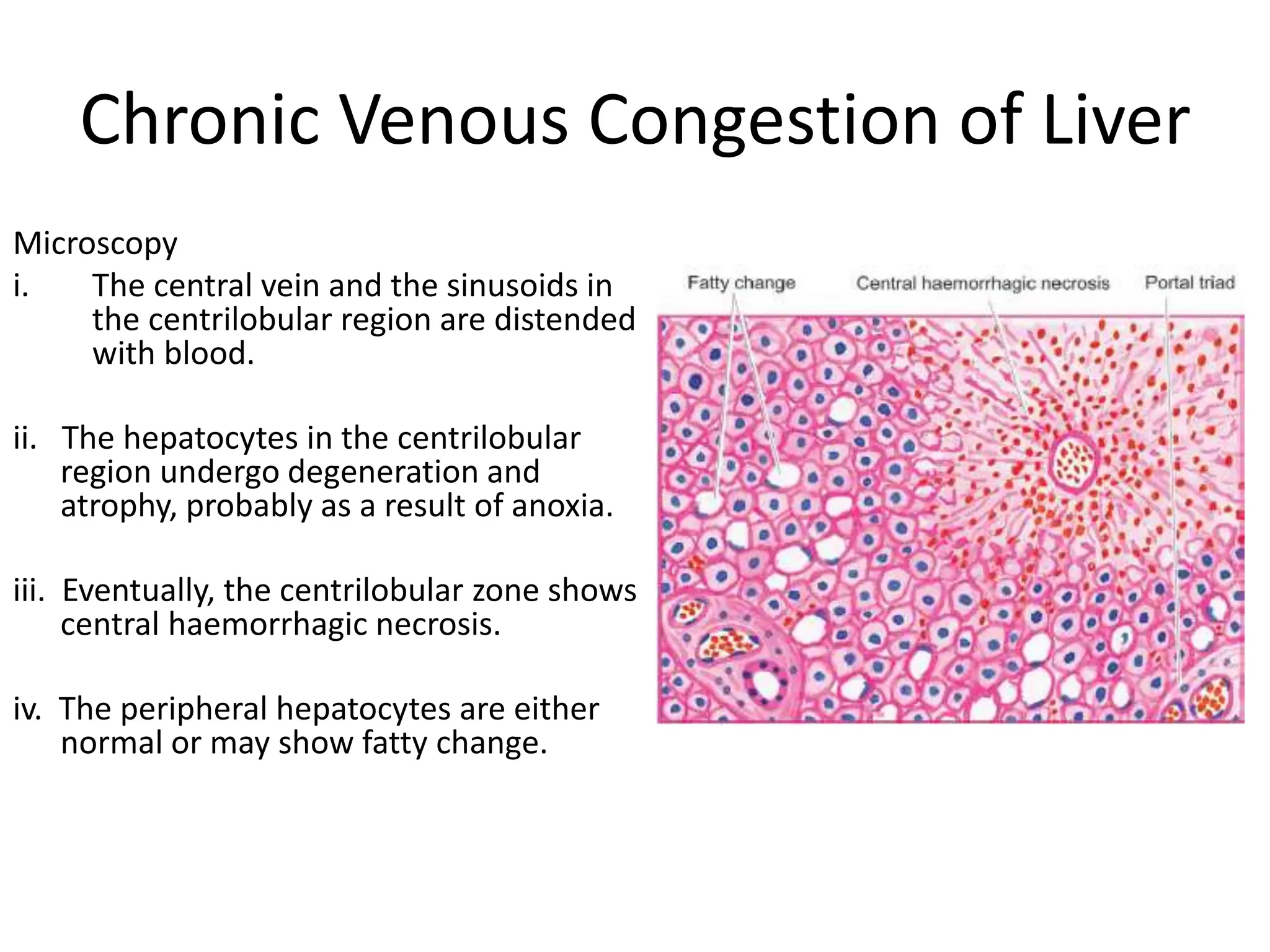 The diseases of the hepatobiliary system | PPTX