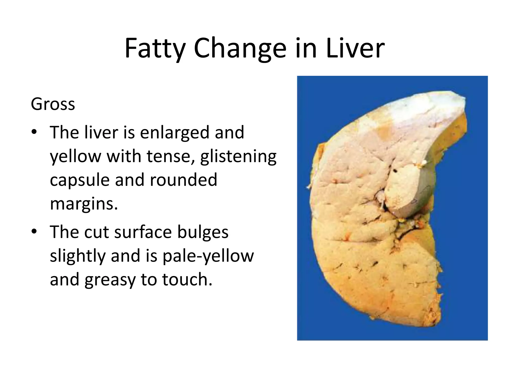 The diseases of the hepatobiliary system | PPTX