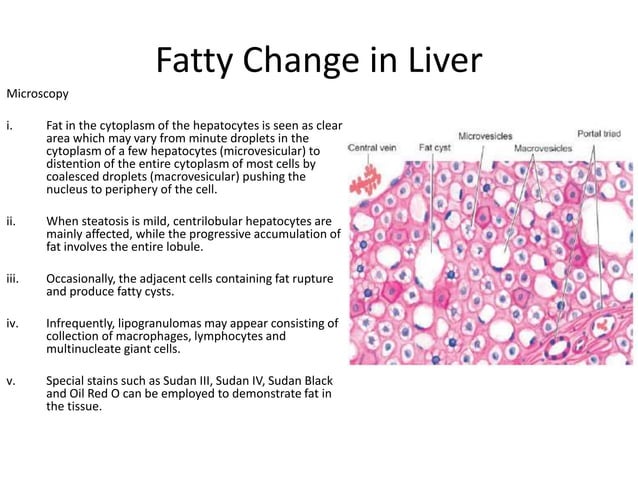 The diseases of the hepatobiliary system | PPTX