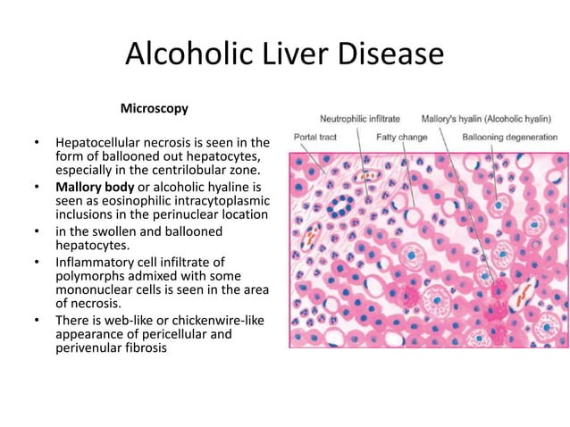 The diseases of the hepatobiliary system | PPTX