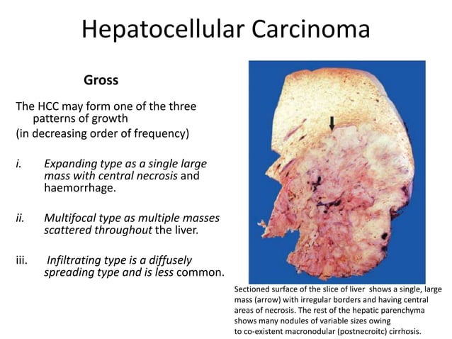 The diseases of the hepatobiliary system | PPTX
