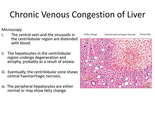 The diseases of the hepatobiliary system | PPTX