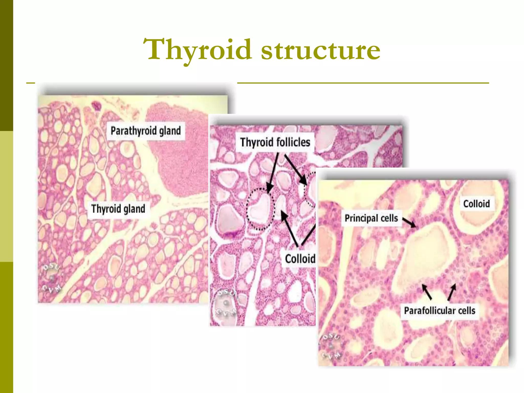 The diseases of thyroid.ppt