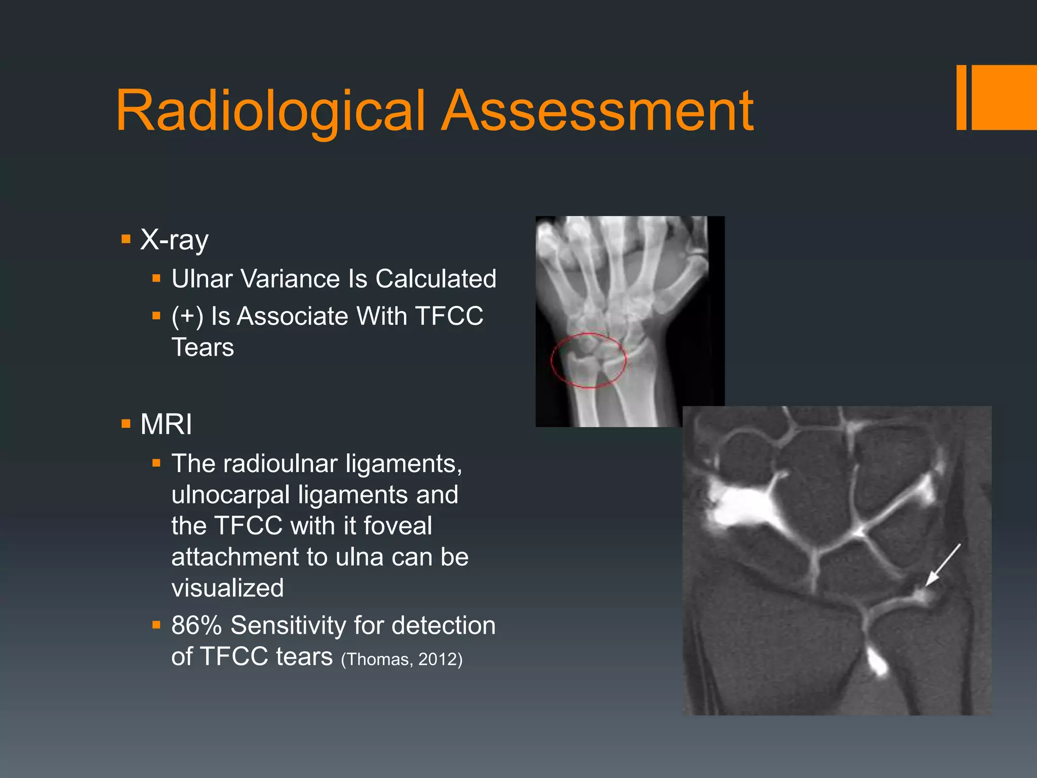 The distal radioulnar joint and tfcc | PPTX