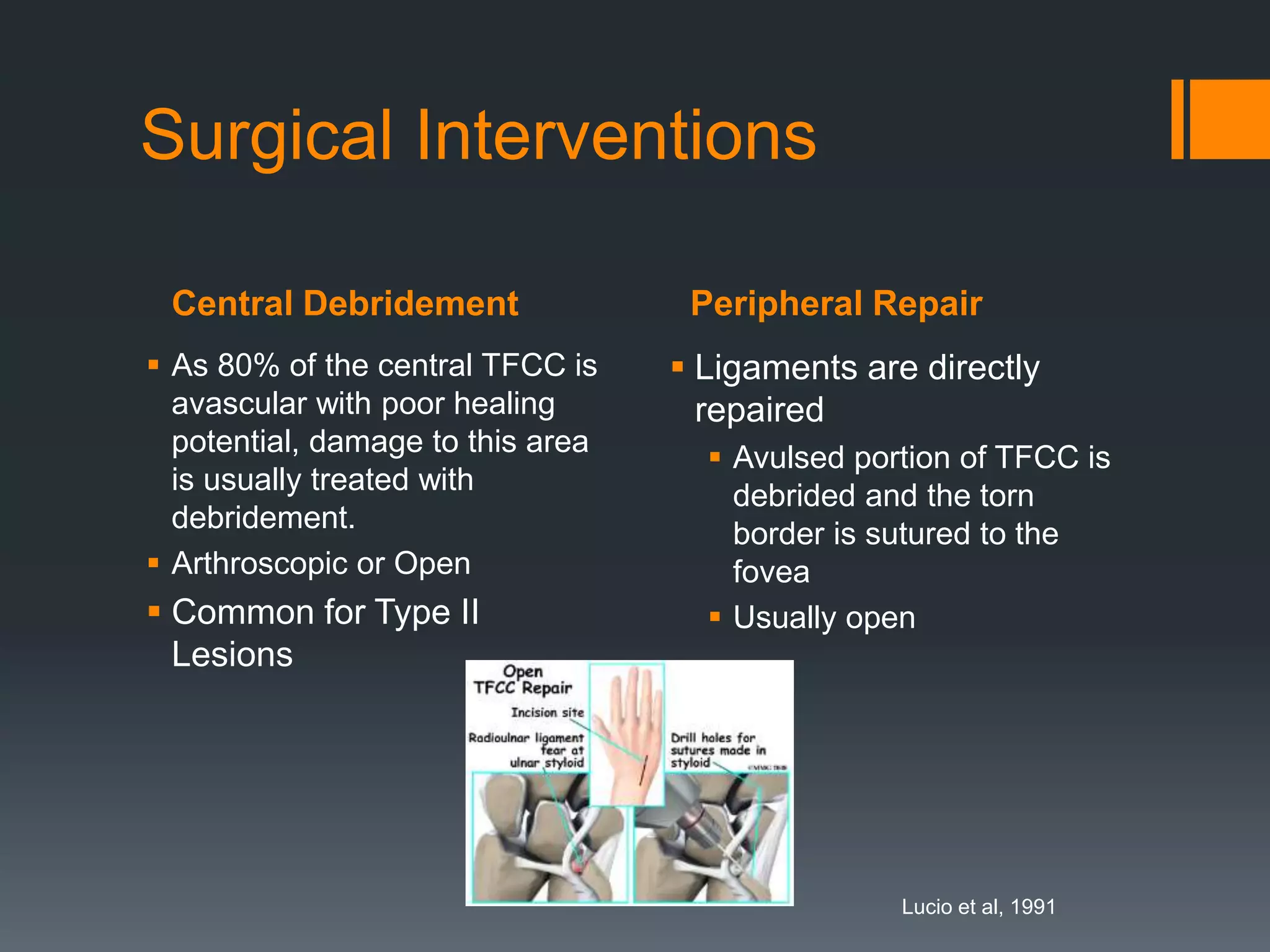 The distal radioulnar joint and tfcc | PPTX