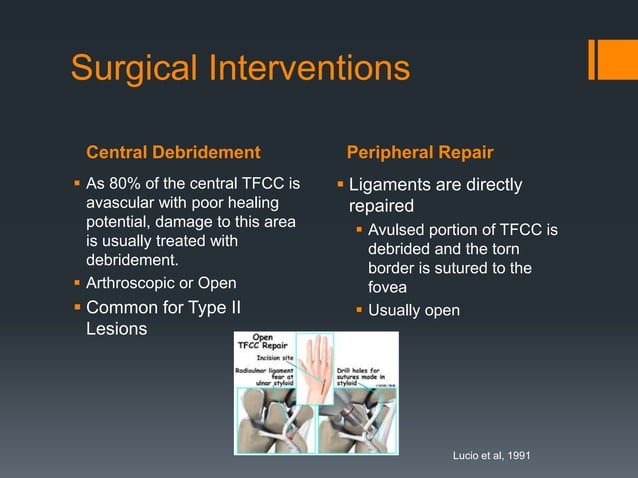 The distal radioulnar joint and tfcc | PPTX