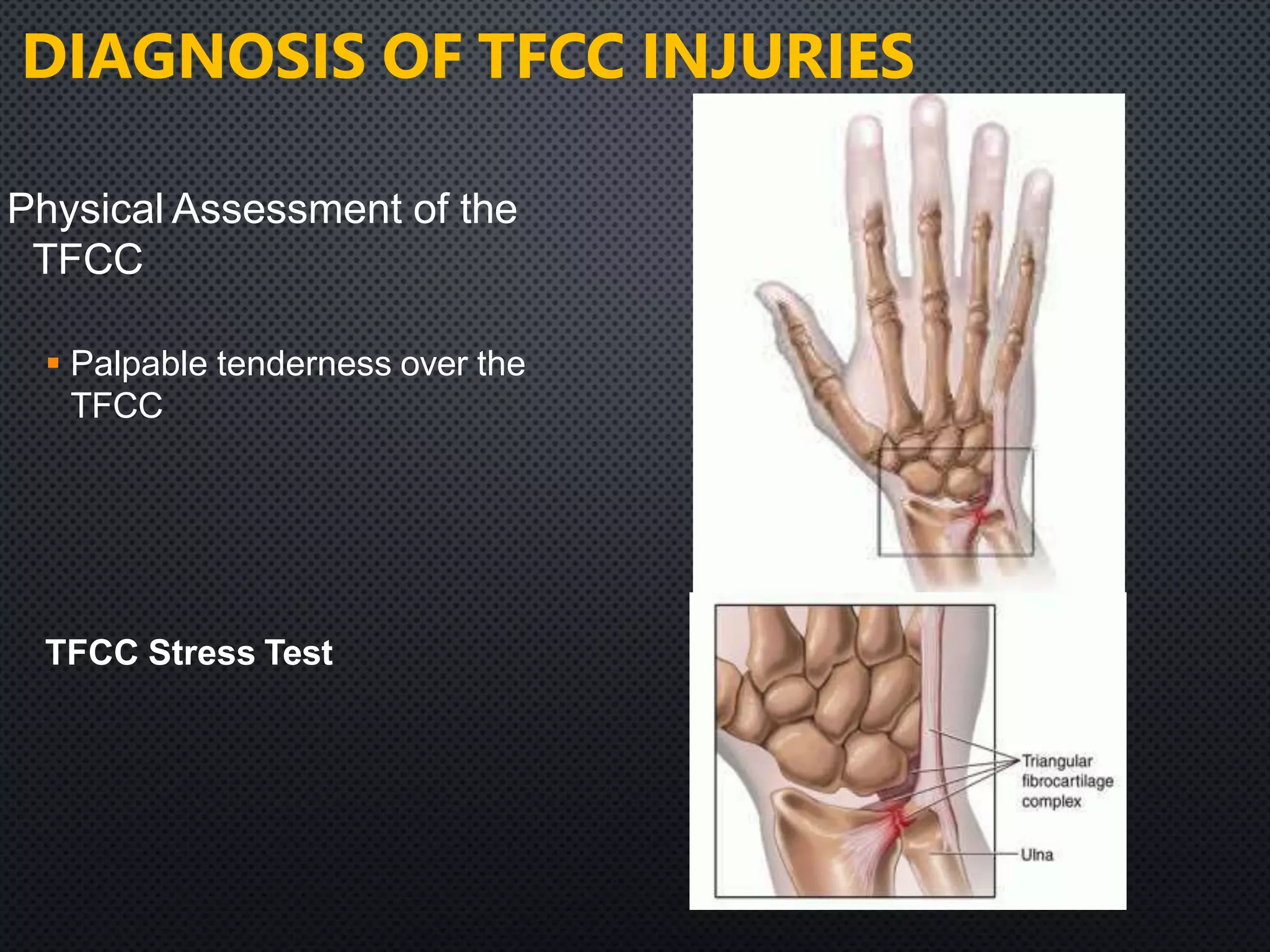 THE DISTAL RADIOULNAR JOINT AND TFCC.pptx