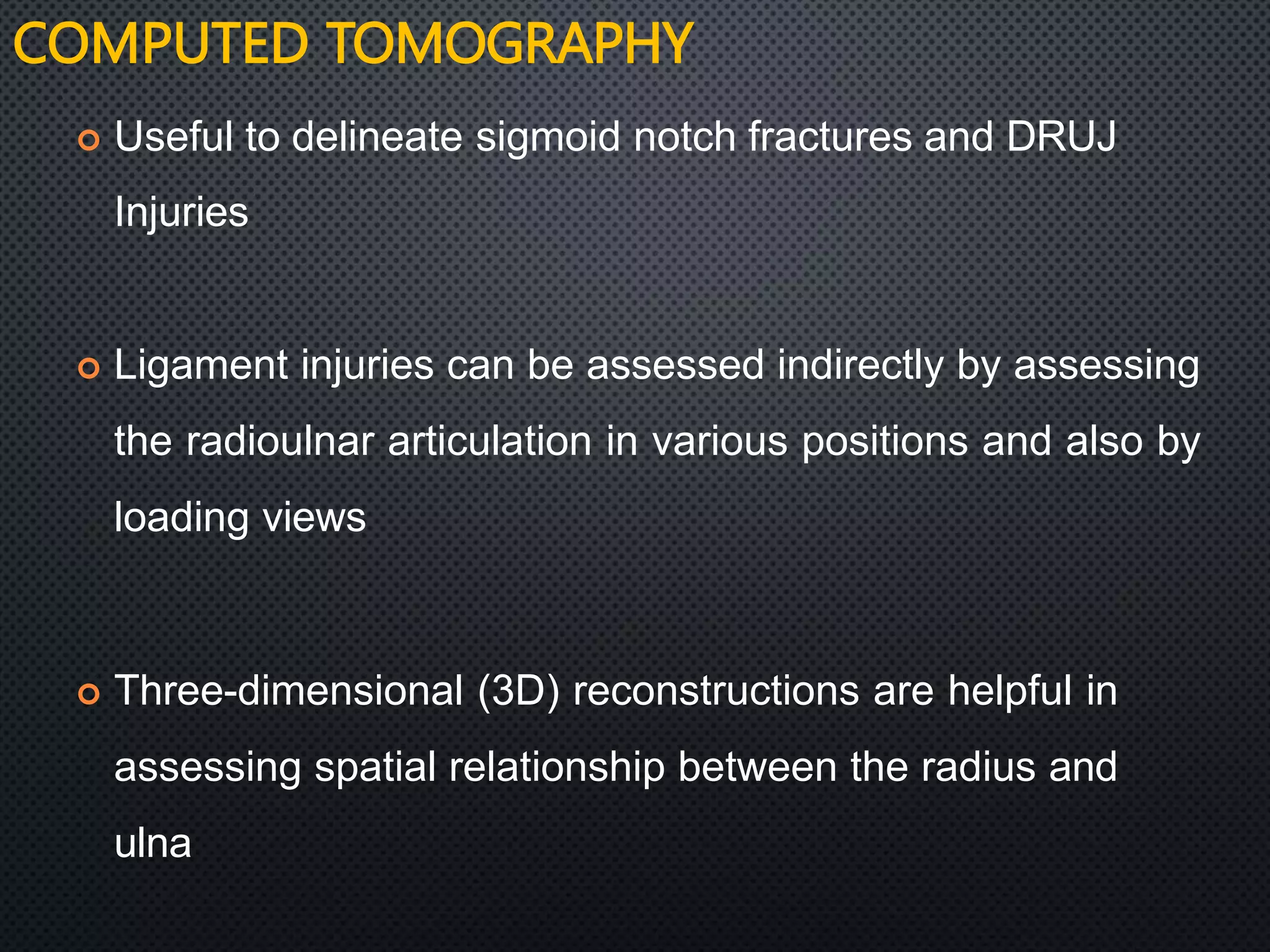 THE DISTAL RADIOULNAR JOINT AND TFCC.pptx