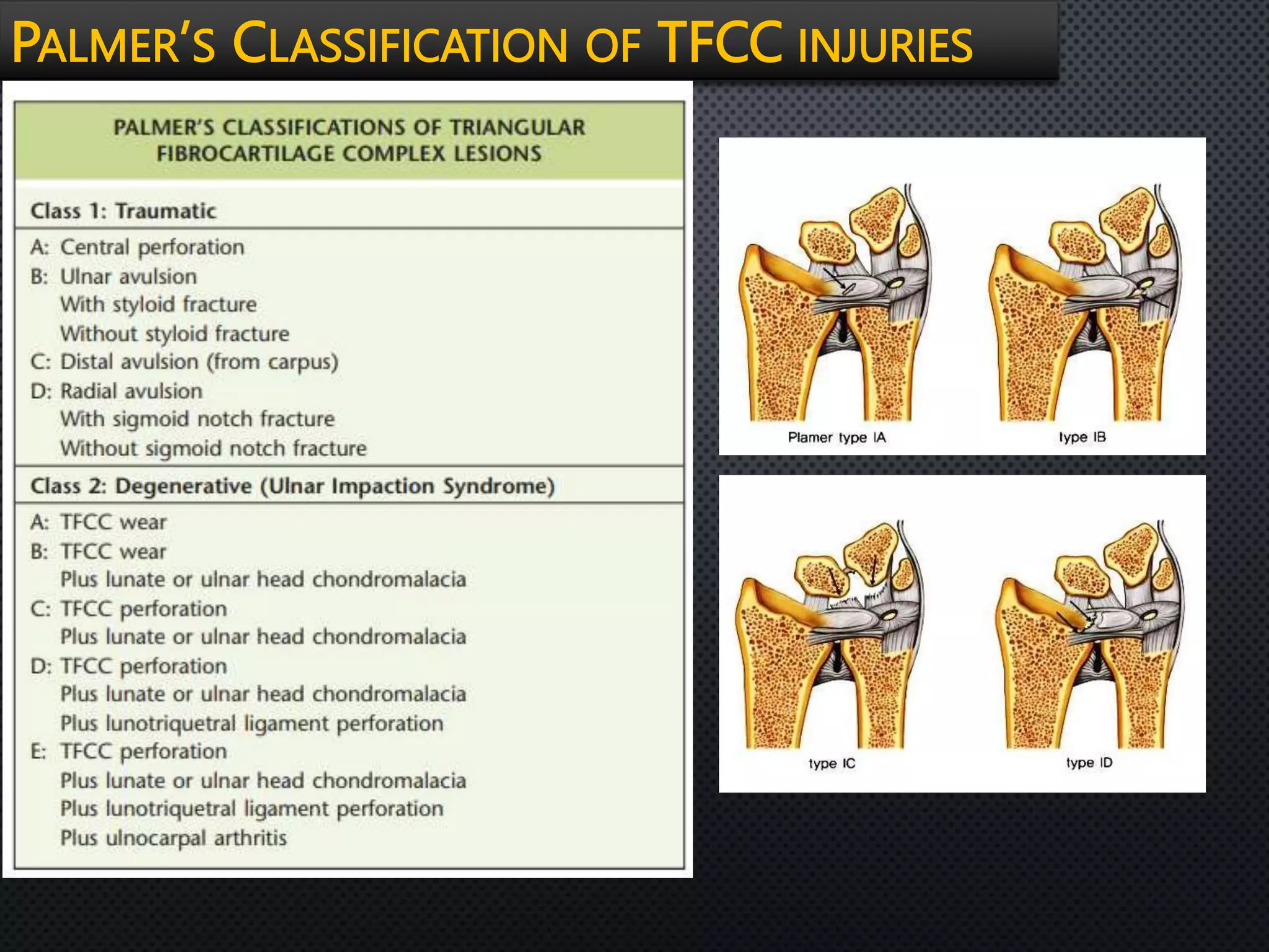 THE DISTAL RADIOULNAR JOINT AND TFCC.pptx