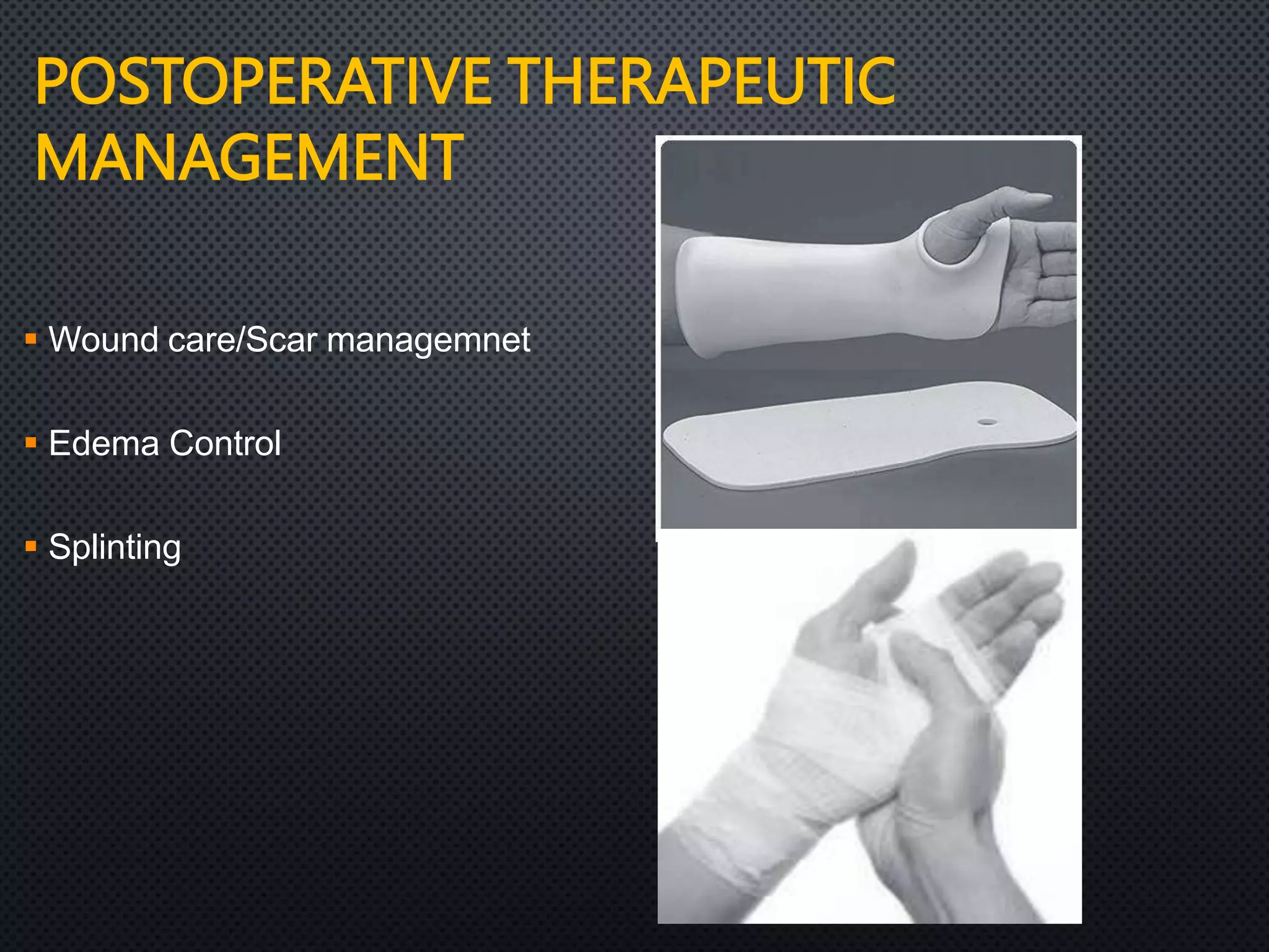 THE DISTAL RADIOULNAR JOINT AND TFCC.pptx