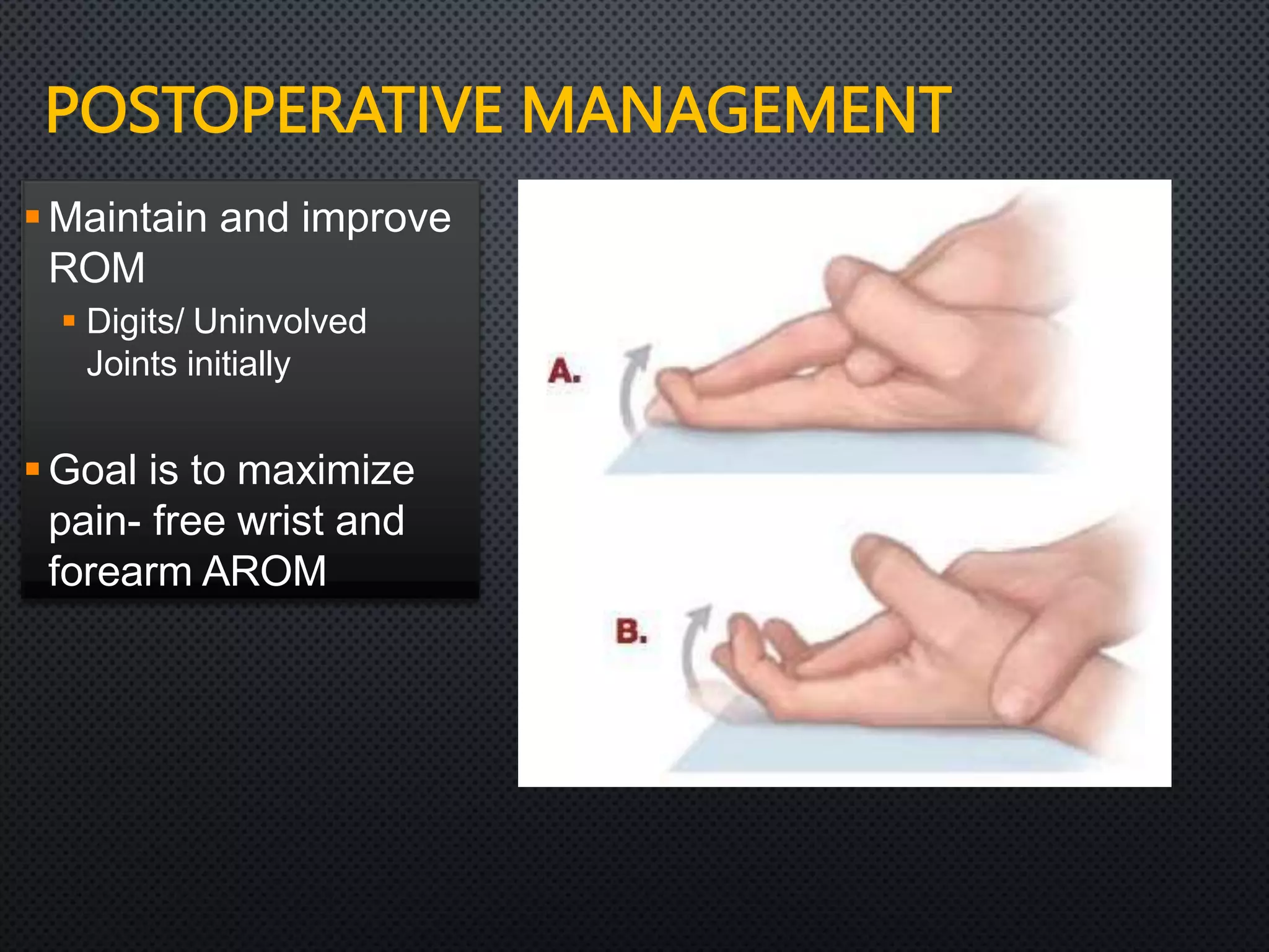 THE DISTAL RADIOULNAR JOINT AND TFCC.pptx