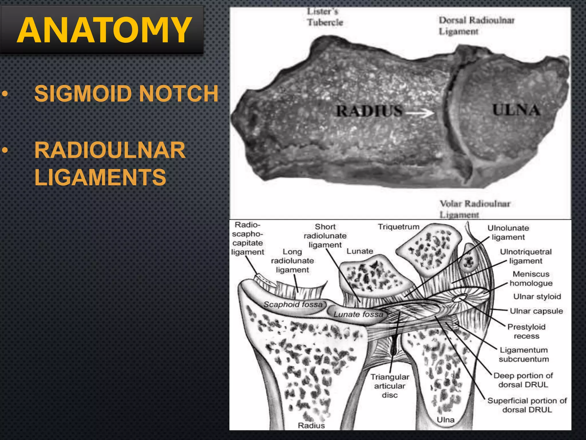 THE DISTAL RADIOULNAR JOINT AND TFCC.pptx