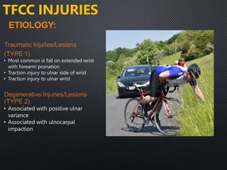 THE DISTAL RADIOULNAR JOINT AND TFCC.pptx