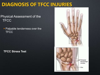 THE DISTAL RADIOULNAR JOINT AND TFCC.pptx