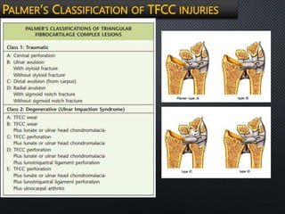THE DISTAL RADIOULNAR JOINT AND TFCC.pptx