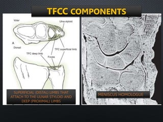 THE DISTAL RADIOULNAR JOINT AND TFCC.pptx