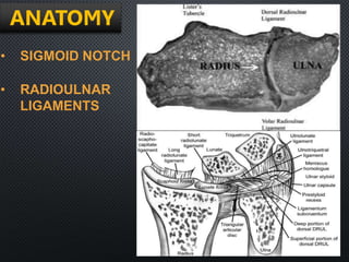 THE DISTAL RADIOULNAR JOINT AND TFCC.pptx