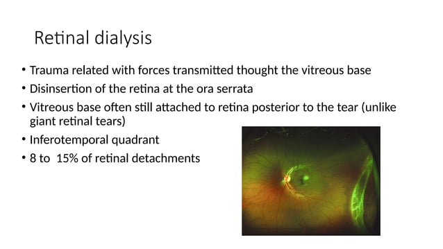 The Dying art of the cryo buckle for retinal detachment surgery.pptx