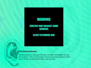 Sound Assignment-The Ear Investigation | PPTX