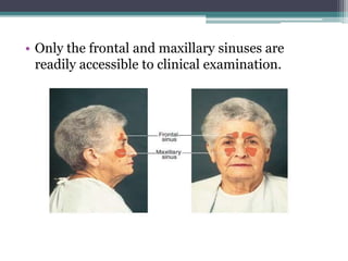 The ear,nose and paranasal sinus | PPTX
