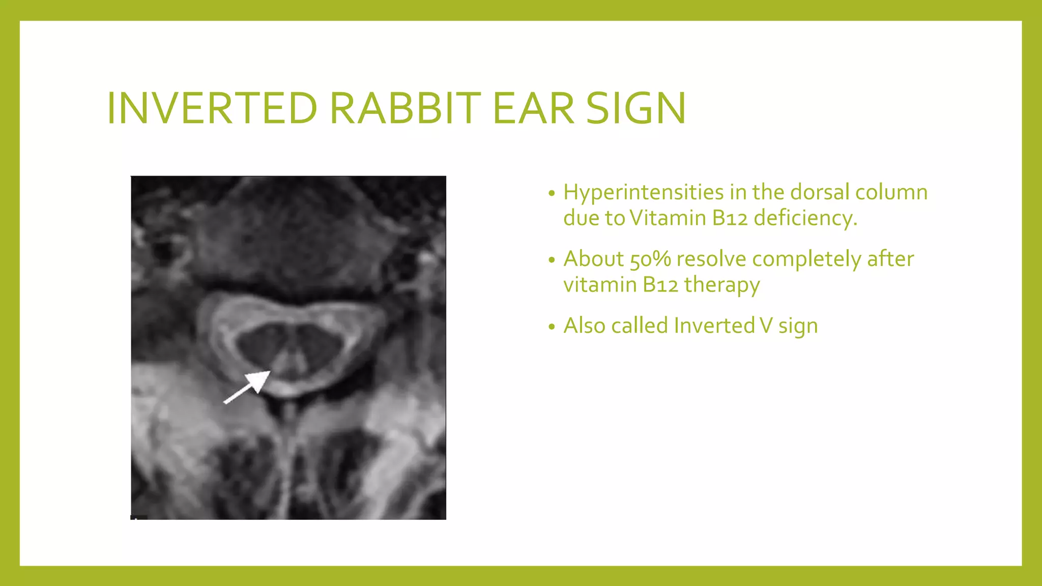 Ear signs in radiology | PPTX