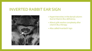 Ear signs in radiology | PPTX