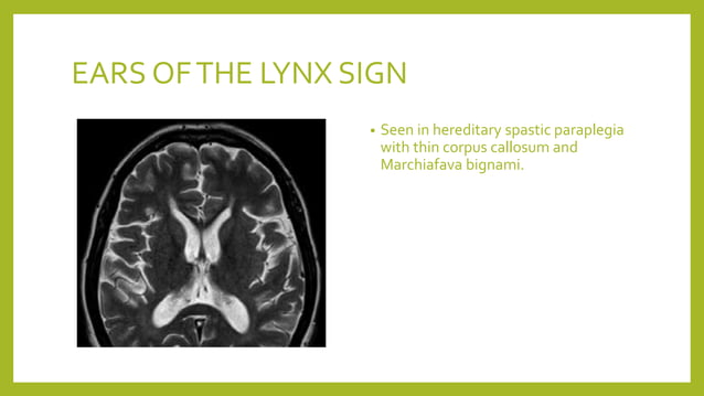 Ear signs in radiology | PPTX | Death, Injury, or Military Conflict ...