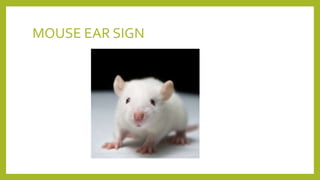 Ear signs in radiology | PPTX