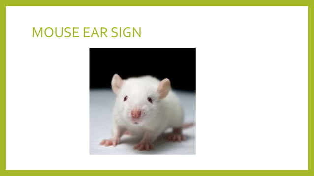 Ear signs in radiology | PPTX | Death, Injury, or Military Conflict ...