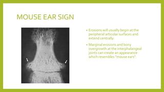 Ear signs in radiology | PPTX