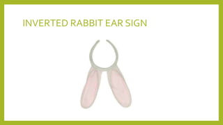 Ear signs in radiology | PPTX