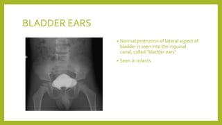 Ear signs in radiology