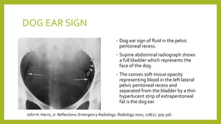 Ear signs in radiology | PPT