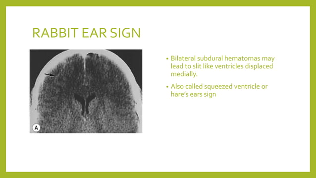 Ear signs in radiology