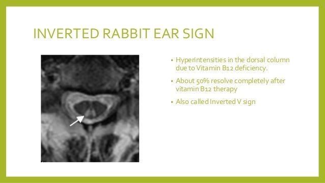 Ear signs in radiology