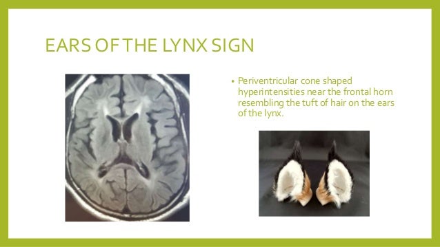 Ear signs in radiology