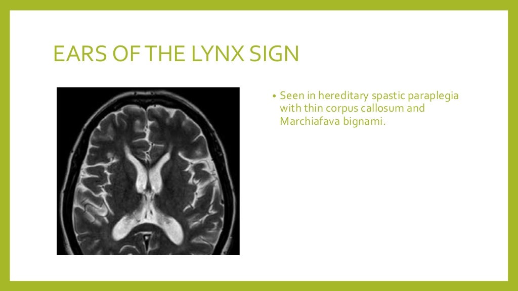 Ear signs in radiology