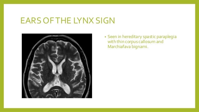 Ear signs in radiology