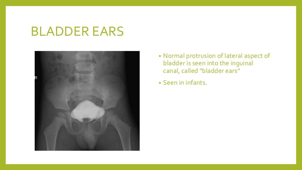 Ear signs in radiology