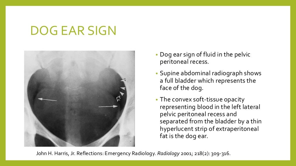 Ear signs in radiology