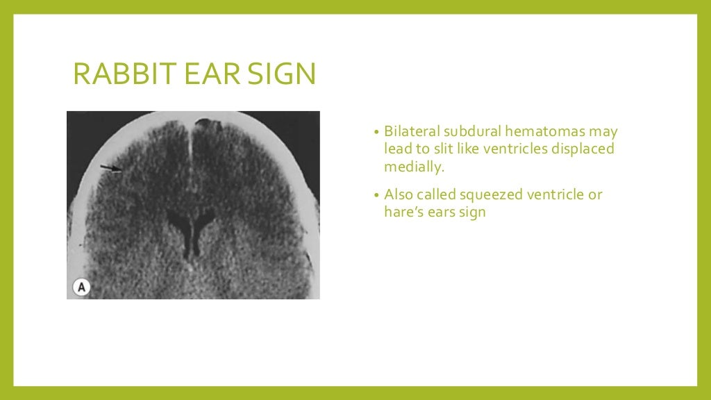 Ear signs in radiology