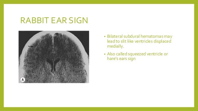 Ear signs in radiology