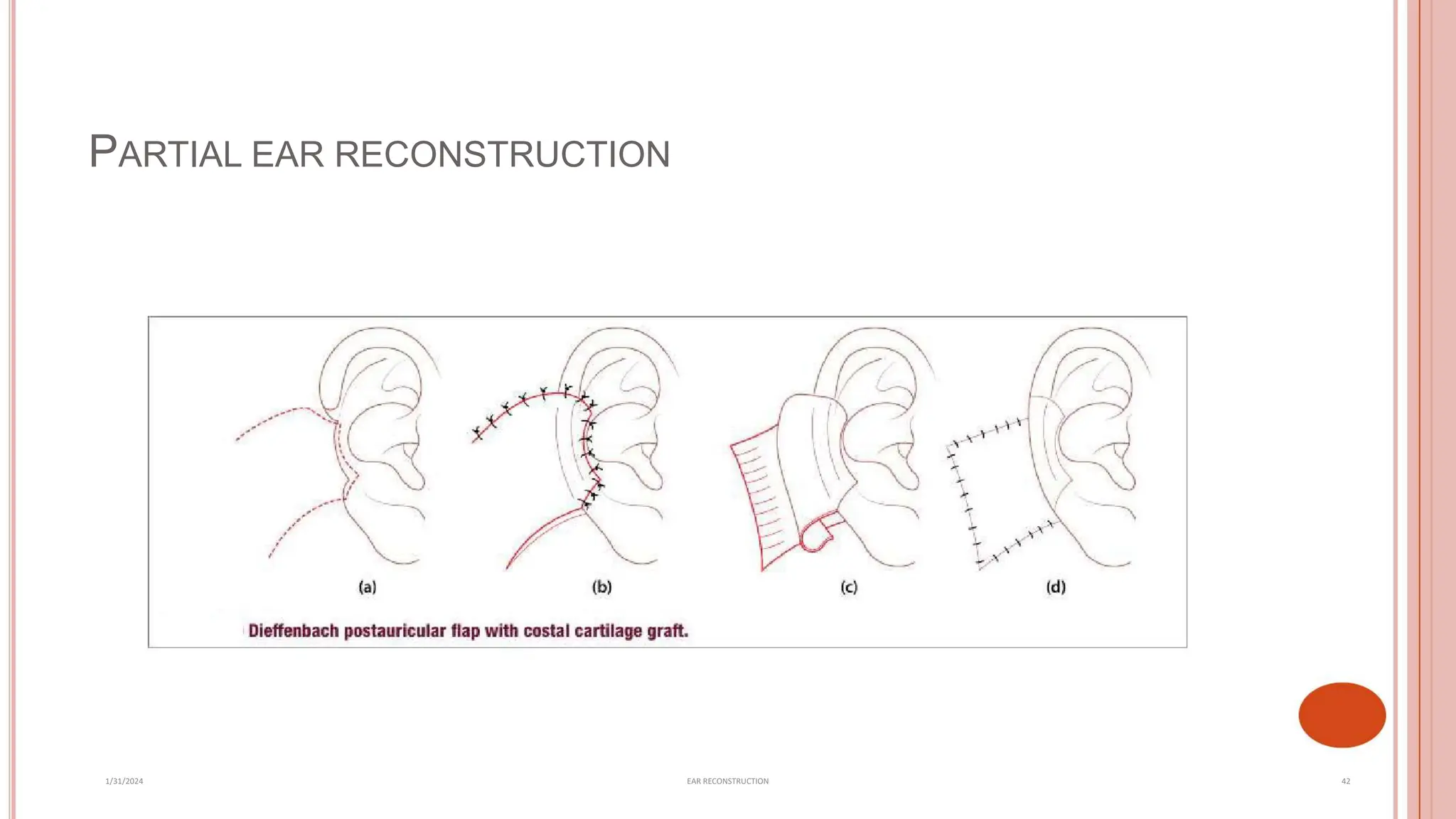 the ear structure.ppt